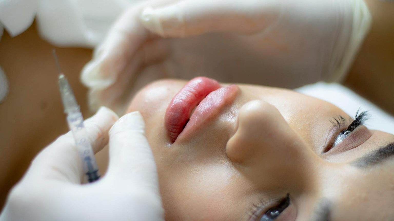 Filler Migration in Malaysia: Causes, Risks & How to Avoid It